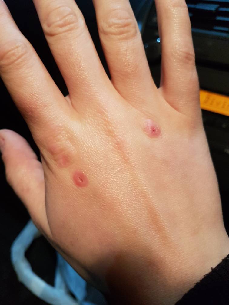 Hidden in plain sight: eating disorders. – From Famine to Feast.